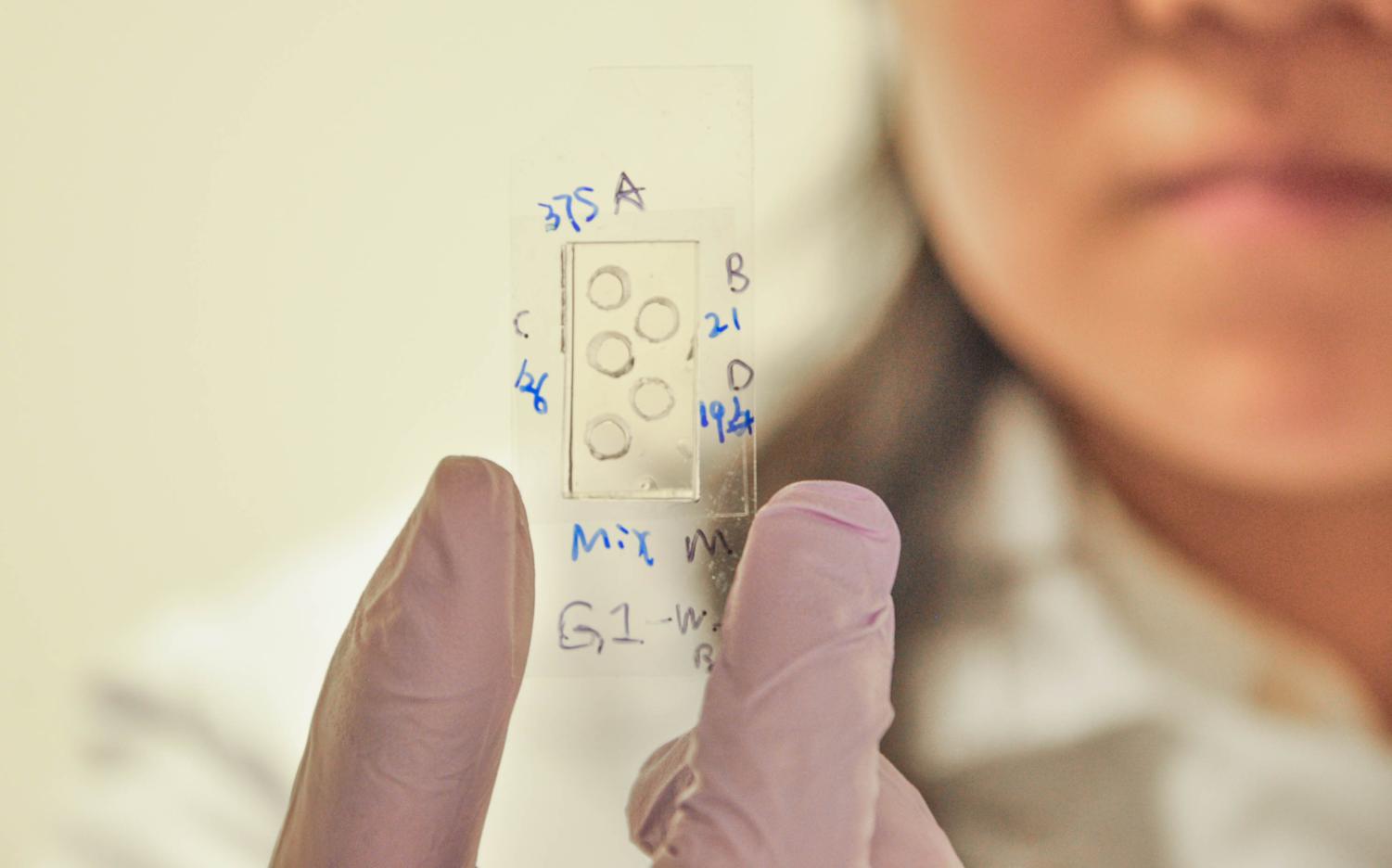 New biosensing technique diagnoses cancer at early stages - The Daily ...